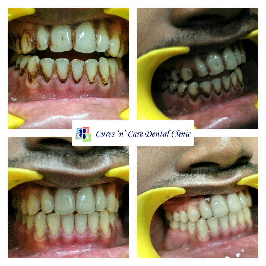 What qualities must be present in a good dentist? – Cures 'n' Care ...